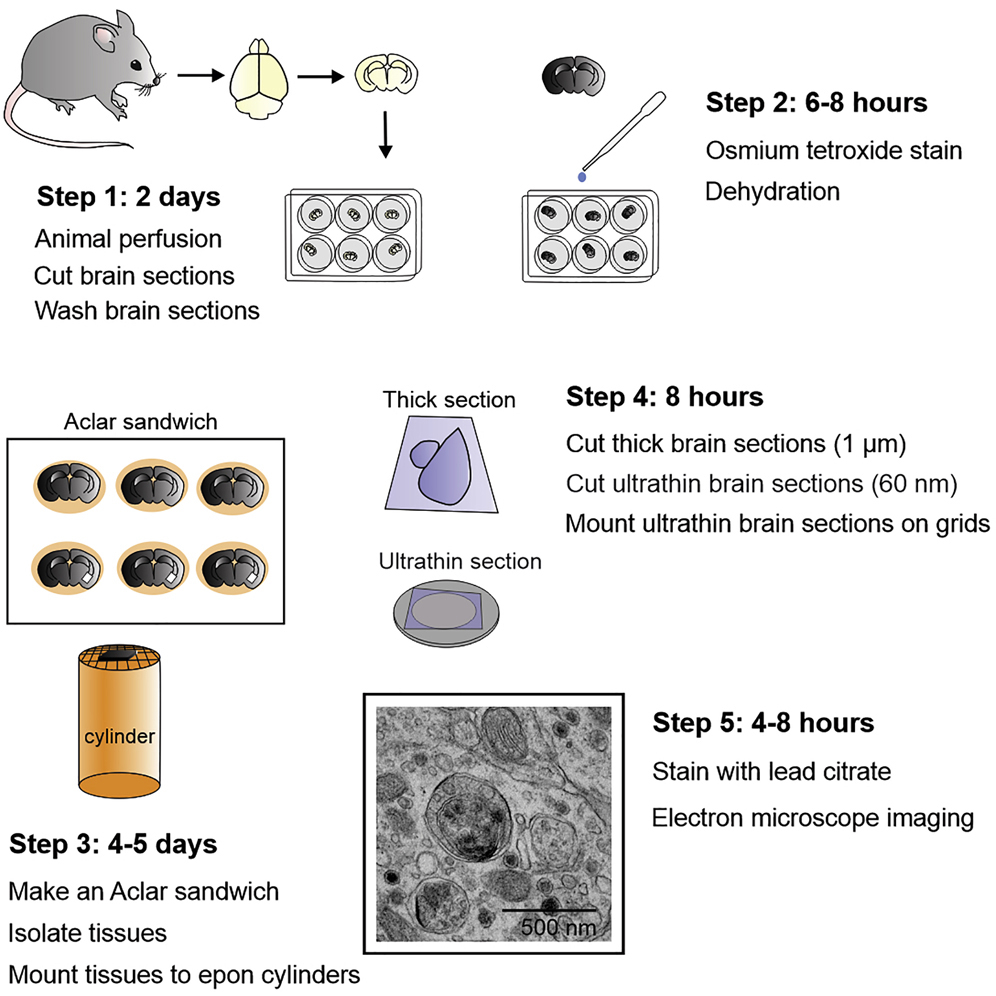 Osmium Tetroxide Stain