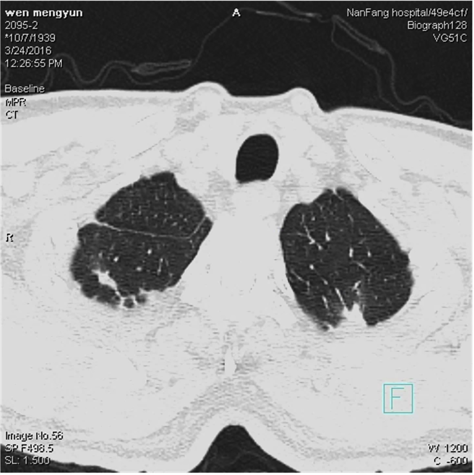 Cell Press: STAR Protocols