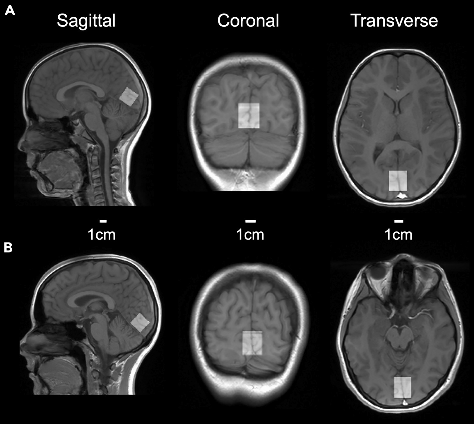 Cell Press: STAR Protocols