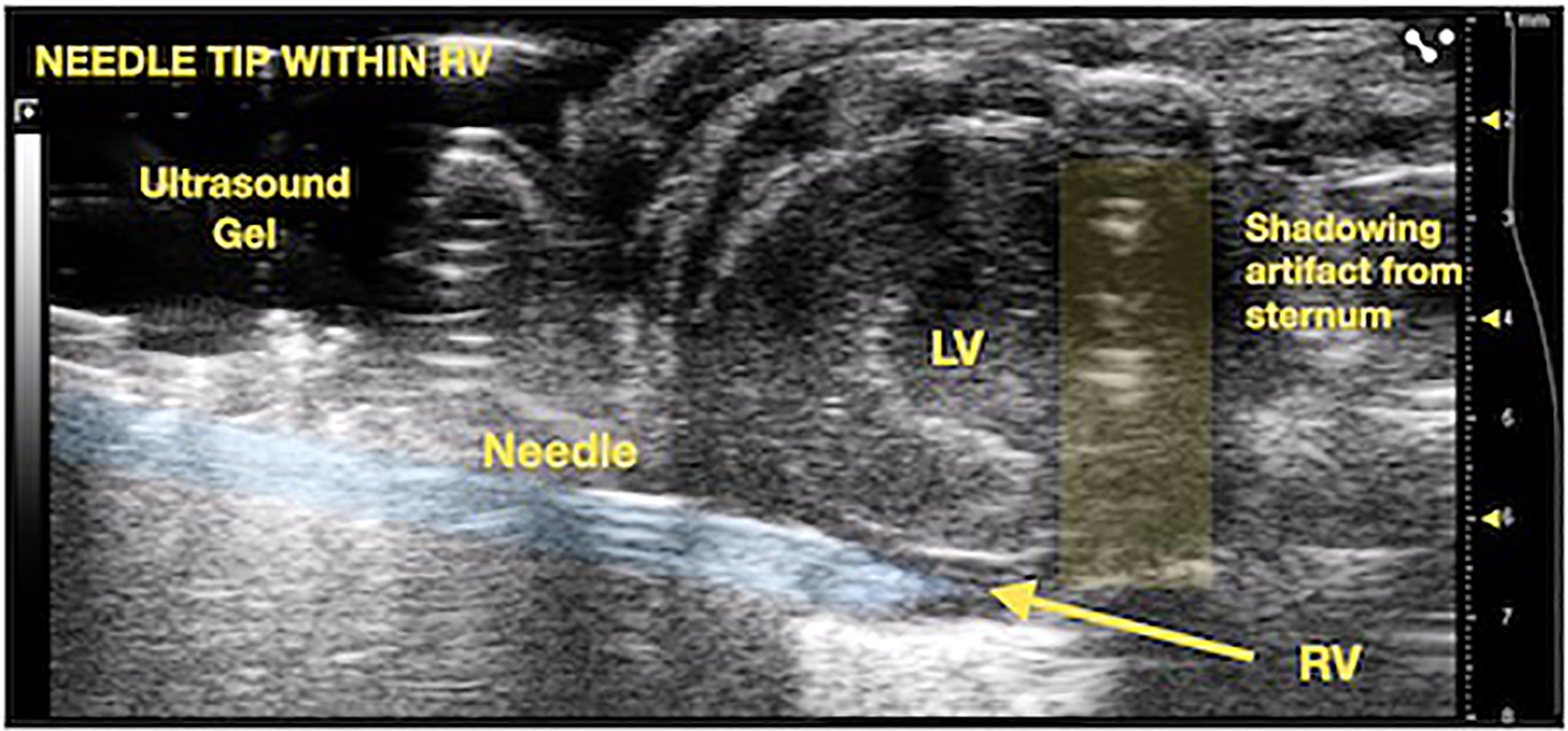 Cell Press: STAR Protocols
