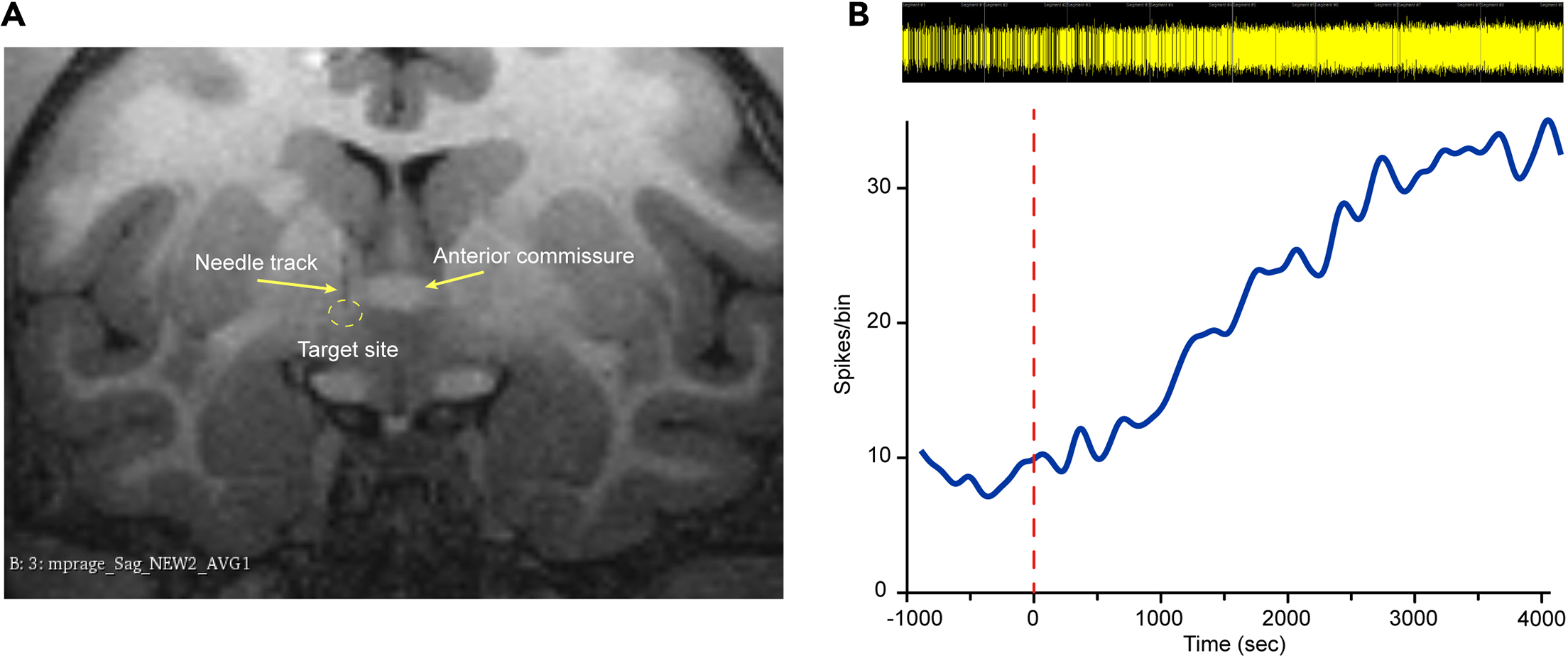Cell Press: STAR Protocols