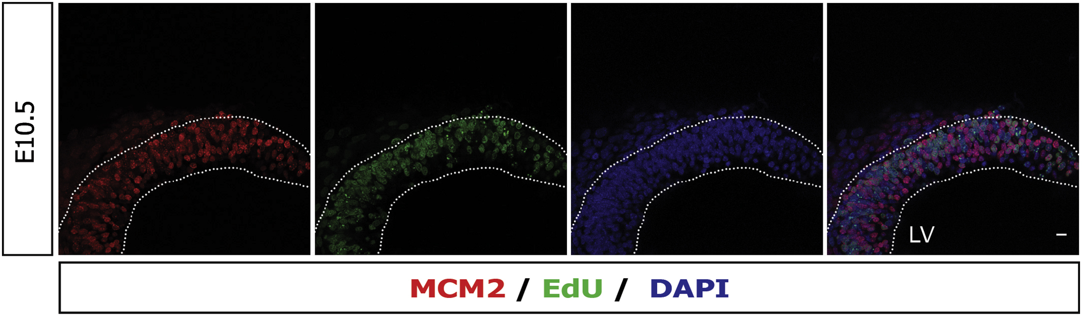 Cell Press: STAR Protocols