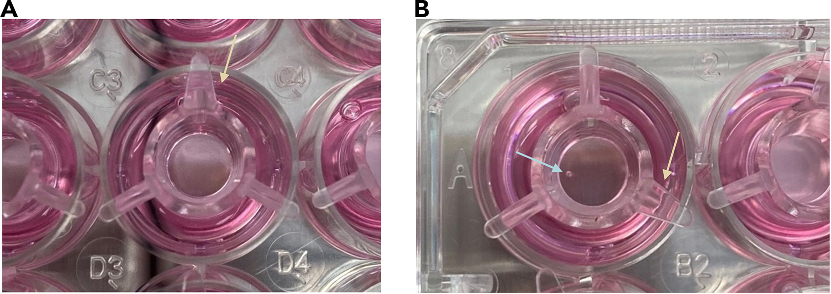 Cell Press: STAR Protocols