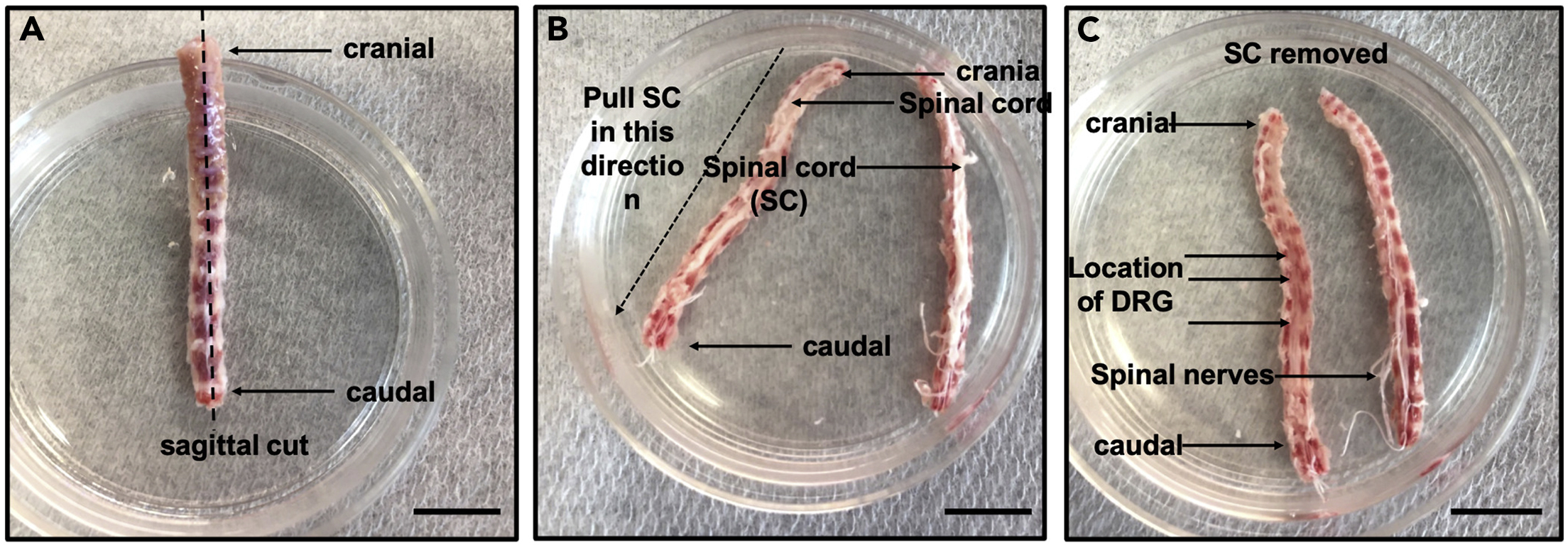 Mouse Dorsal Root Ganglion