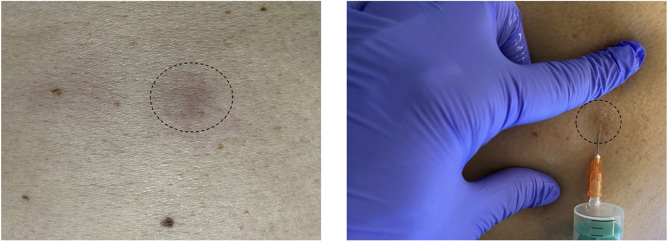 Cell Press: STAR Protocols